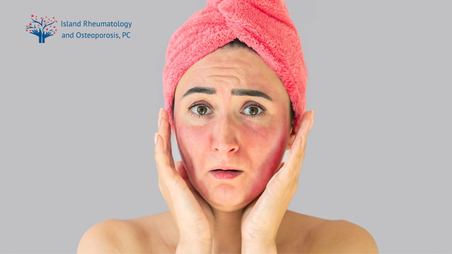 Lupus and Skin: Signs, Diagnosis & Treatment | Island Rheumatology, PC